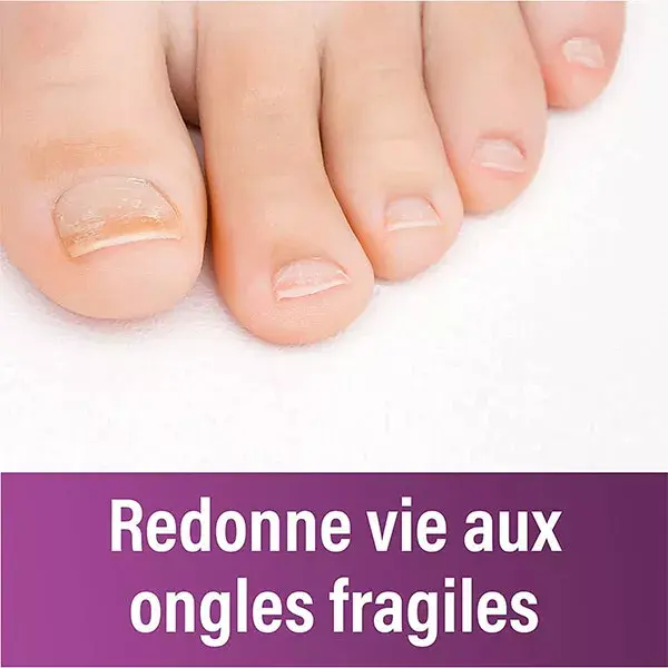 Emtrix Patch Nuit Traitement Mycose de l'Ongle 14 patchs | Pas cher